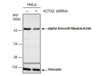 Anti-alpha smooth muscle Actin Rabbit mAb