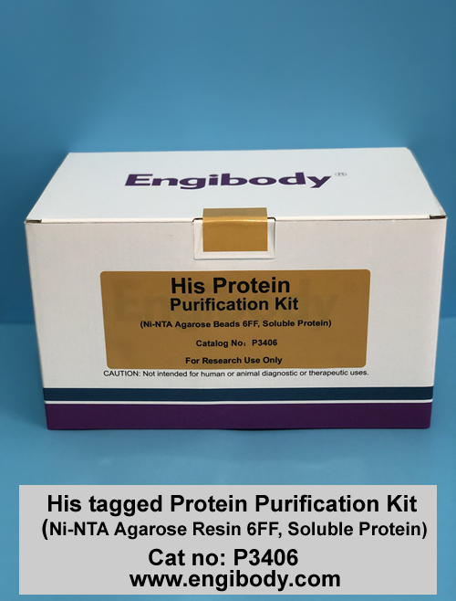 His tagged Protein Purification Kit